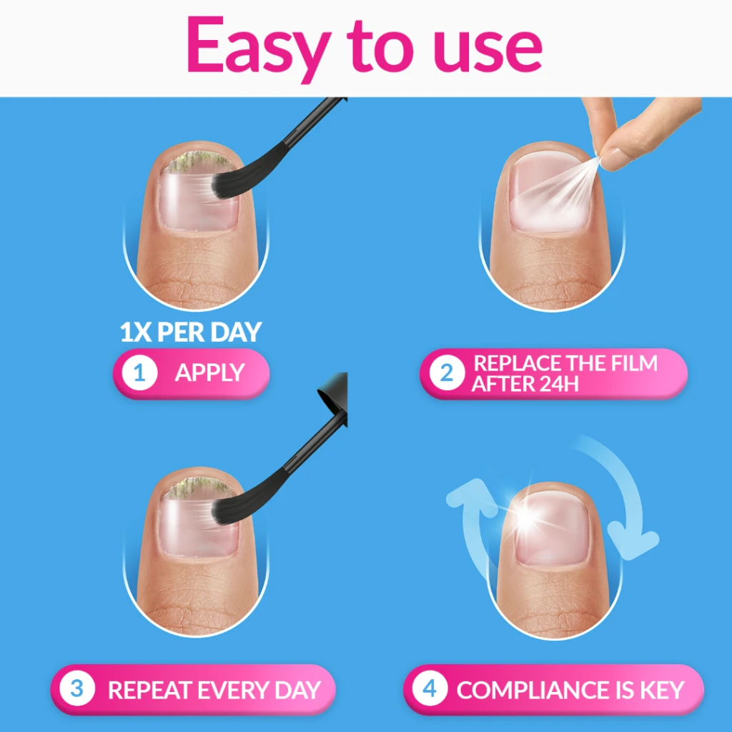 Excilor Nail Fungus Ultra for persistent nail fungus