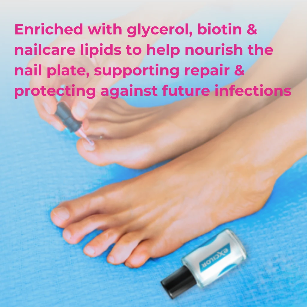 Excilor Nail Fungus Ultra for persistent nail fungus