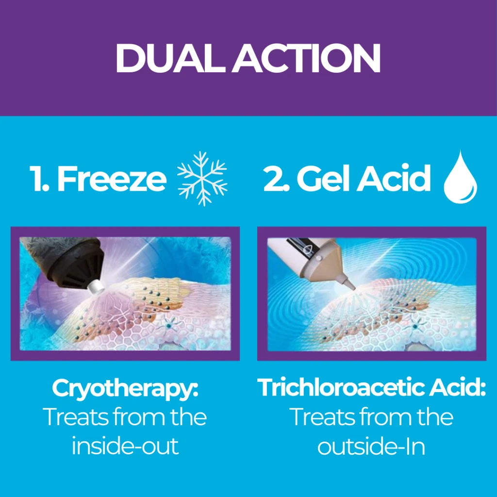 Excilor Warts Duo Power : Extra Strong Cryo + Acid Treatment
