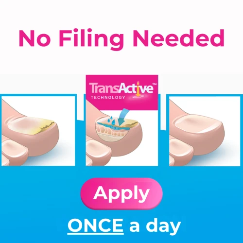 Excilor Nail Fungus Easy Pen: Clinically Proven Treatment