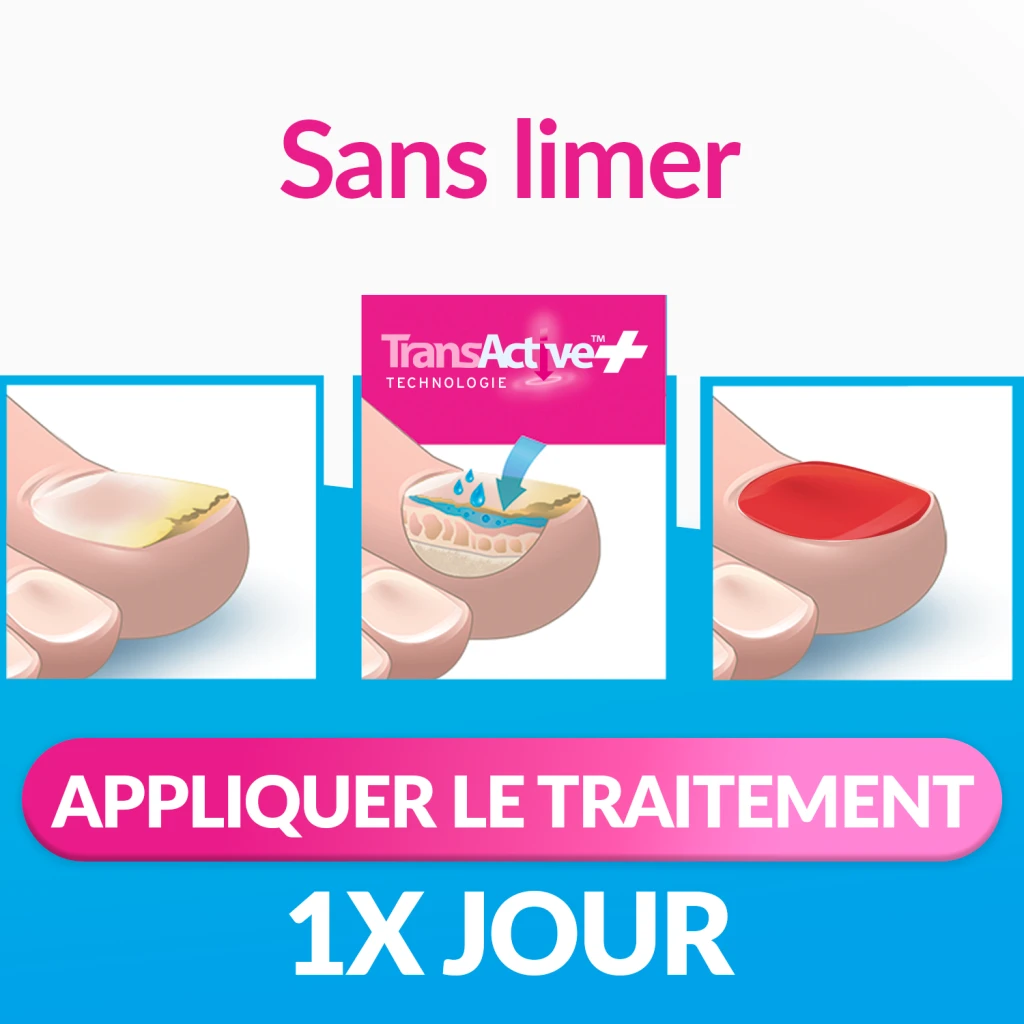 Excilor Forte Color Rouge traitement mycose de l'ongle