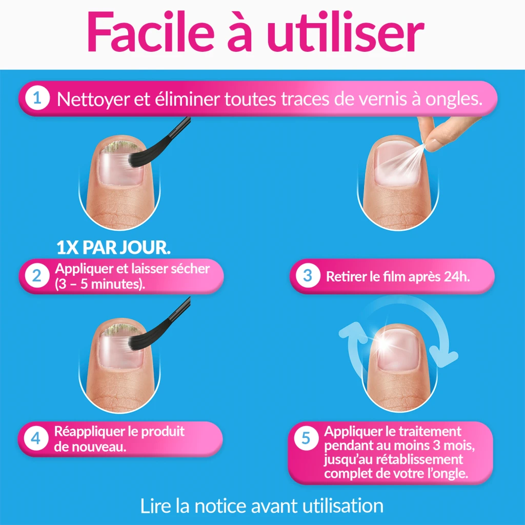 Excilor Traitement de la Mycose de l'Ongle Forte 30ml