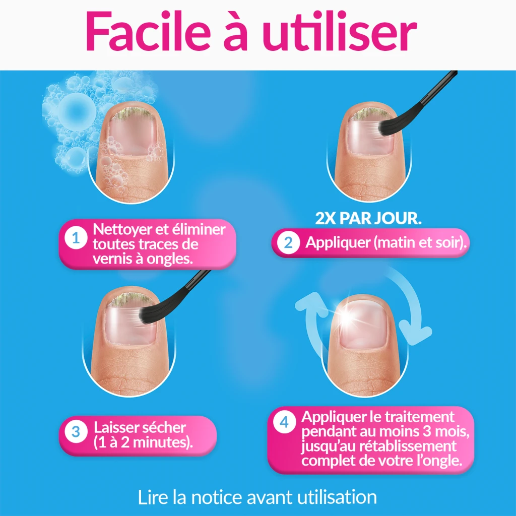 Excilor Solution Traitement de la Mycose de l'Ongle 3,3ml