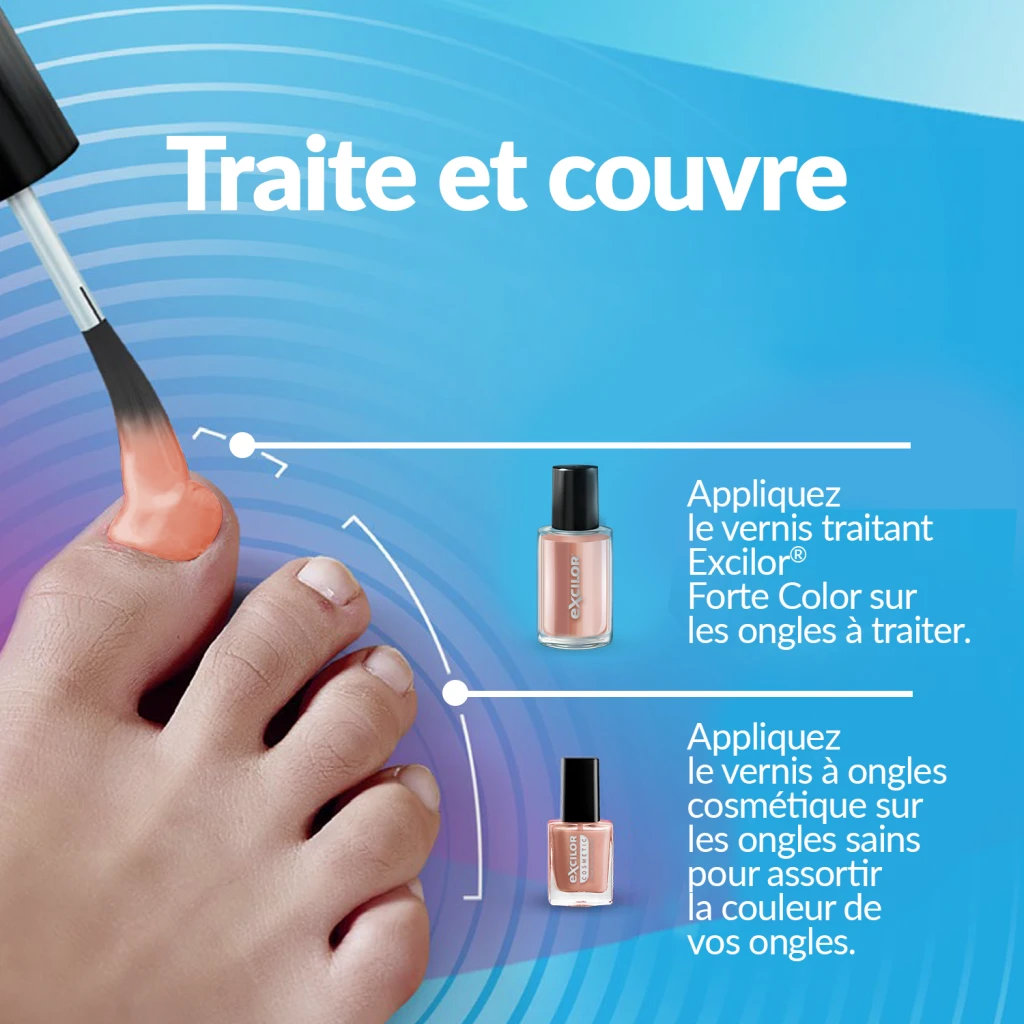 Excilor Forte Color Nude traitement mycose de l'ongle