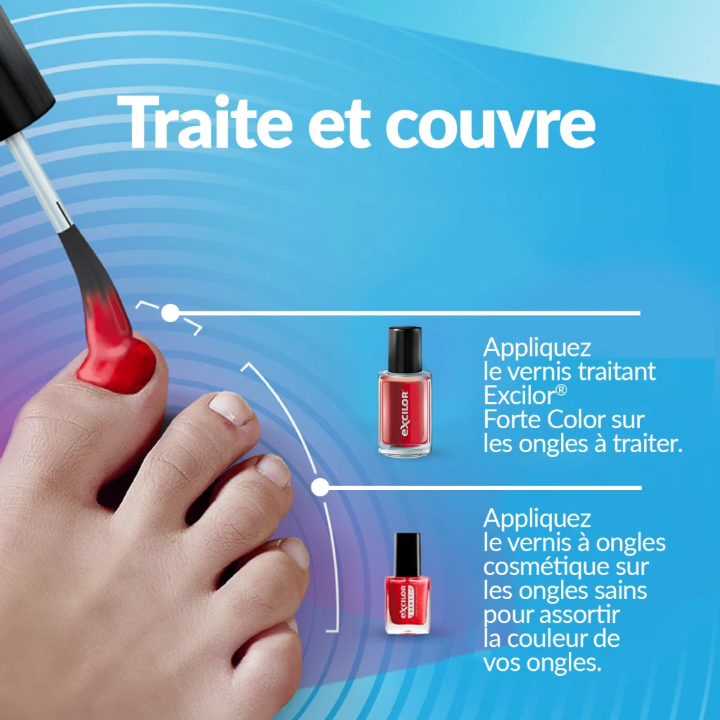 Excilor Forte Color Rouge traitement mycose de l'ongle