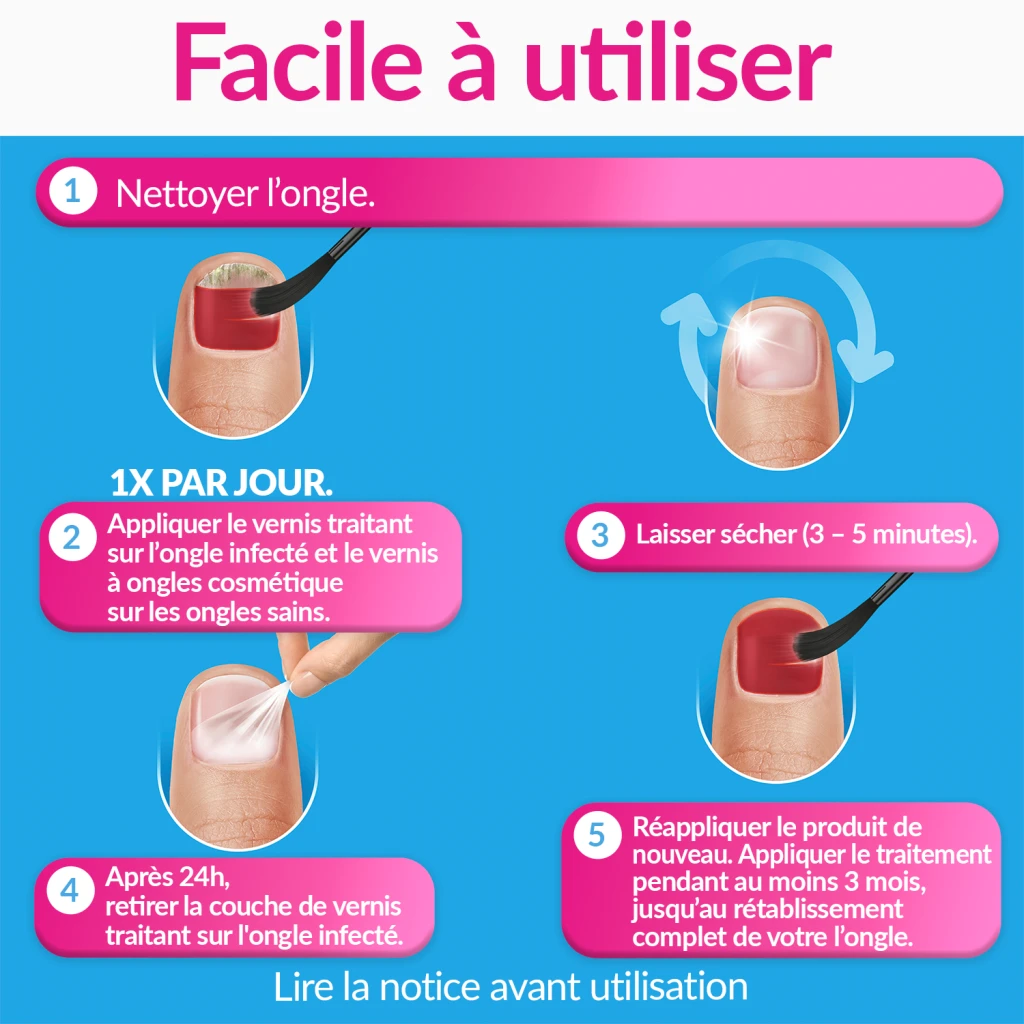 Excilor Forte Color Rouge traitement mycose de l'ongle