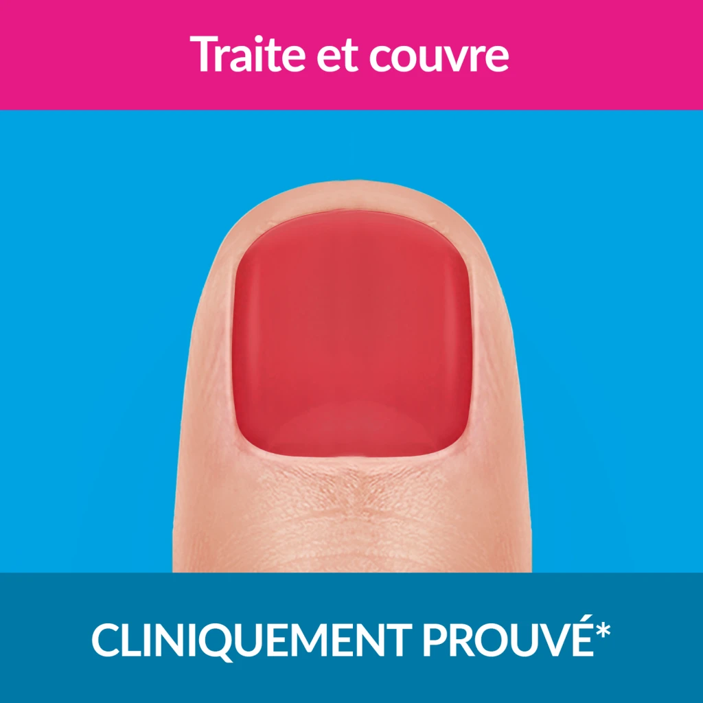 Excilor Forte Color Rouge traitement mycose de l'ongle