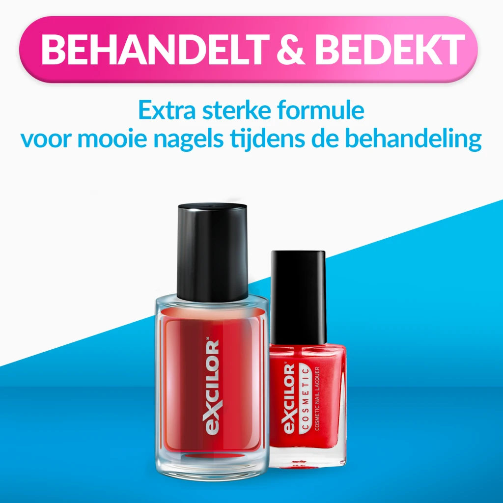 Excilor Forte Color behandeling tegen schimmelnagels
