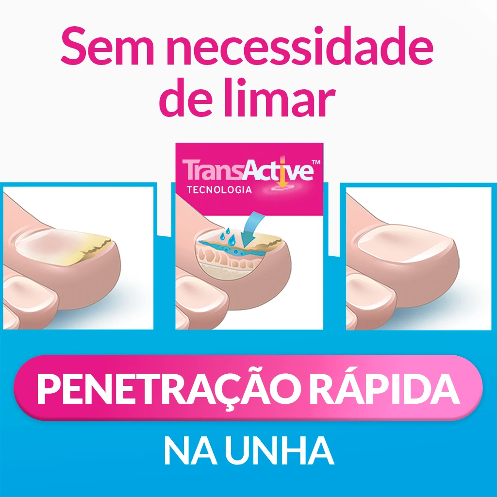 Excilor Easy - Infeção fúngica das unhas - Secagem rápida