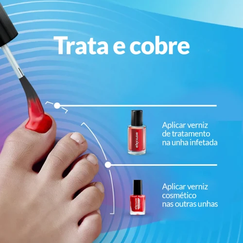 Excilor Forte Color Red contra os fungos das unhas